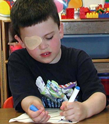 Crossed Eyes (Strabismus) – Symptoms and Treatments of Crossed Eyes ...
