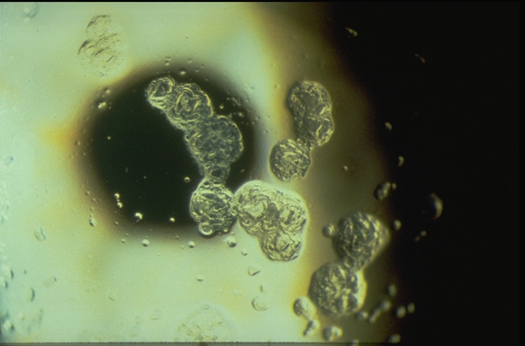 Soft Contact Lenses : Bausch + Lomb