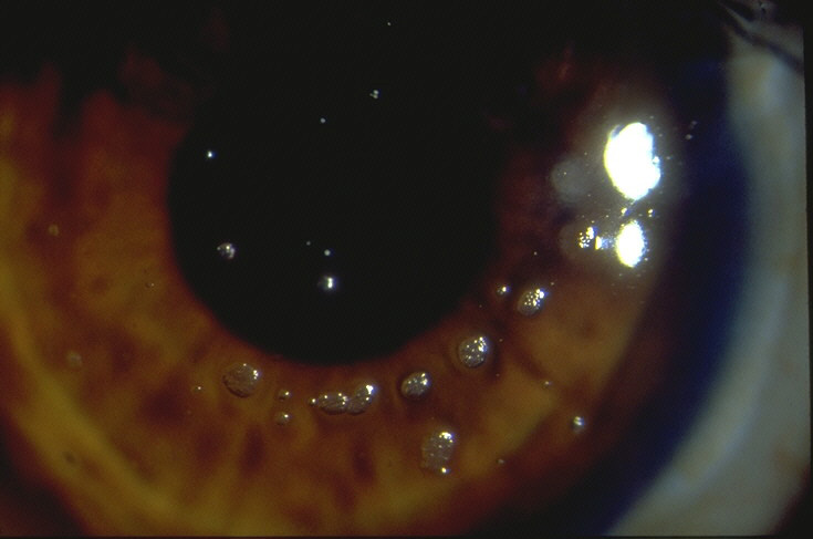 Soft Contact Lenses : Bausch + Lomb